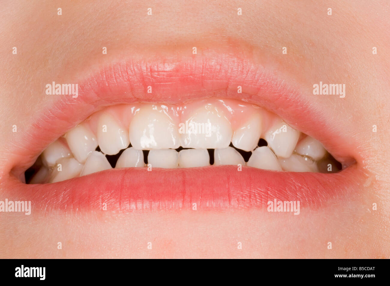 Nice set of teeth hi-res stock photography and images - Alamy