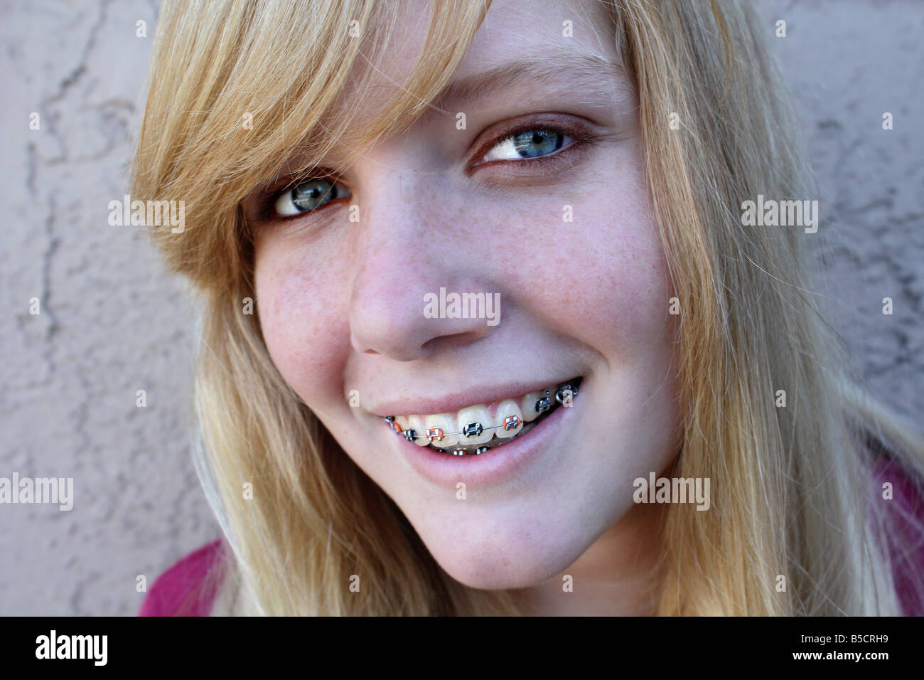 Big smile with braces hi-res stock photography and images - Alamy