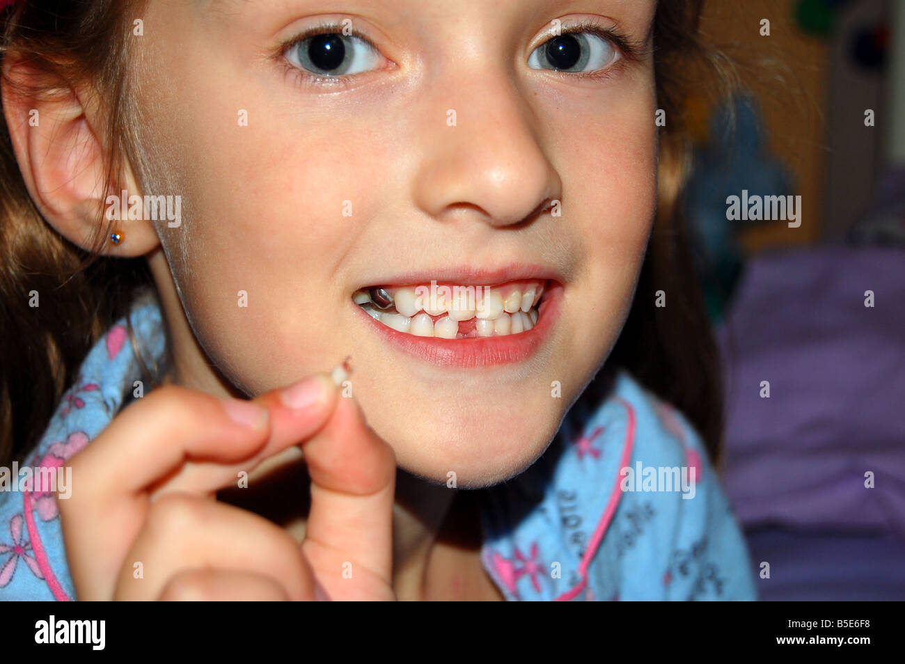 Child (6 years old) holding tooth that had just fallen out Stock Photo ...