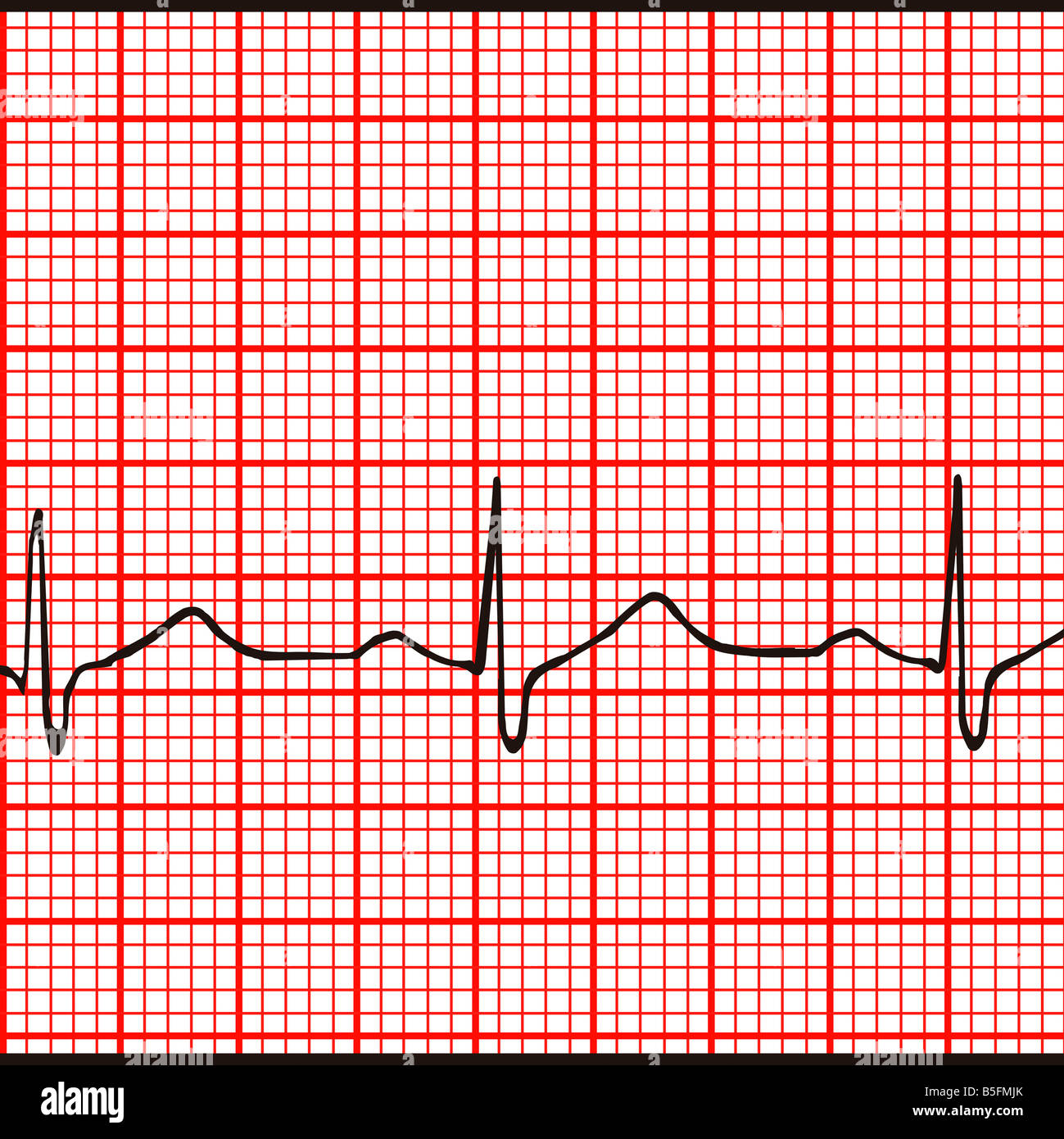 Electrocardiogram EKG graph printout Stock Photo - Alamy
