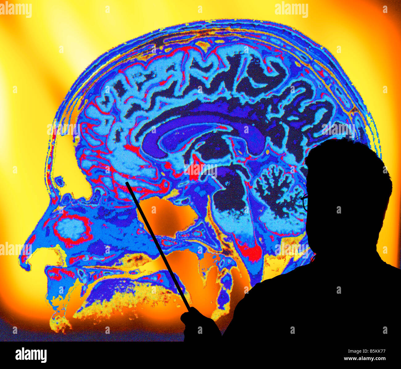 doctor studying color coded human skull Stock Photo - Alamy