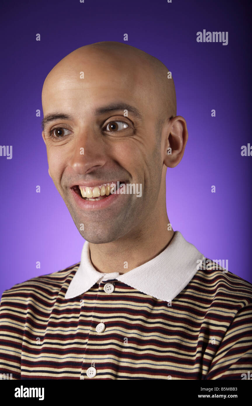 Portrait of bald young man Stock Photo - Alamy