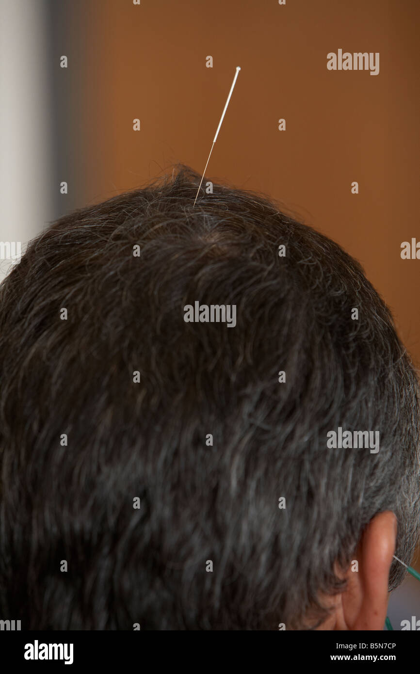 Needles sticking out hi-res stock photography and images - Alamy