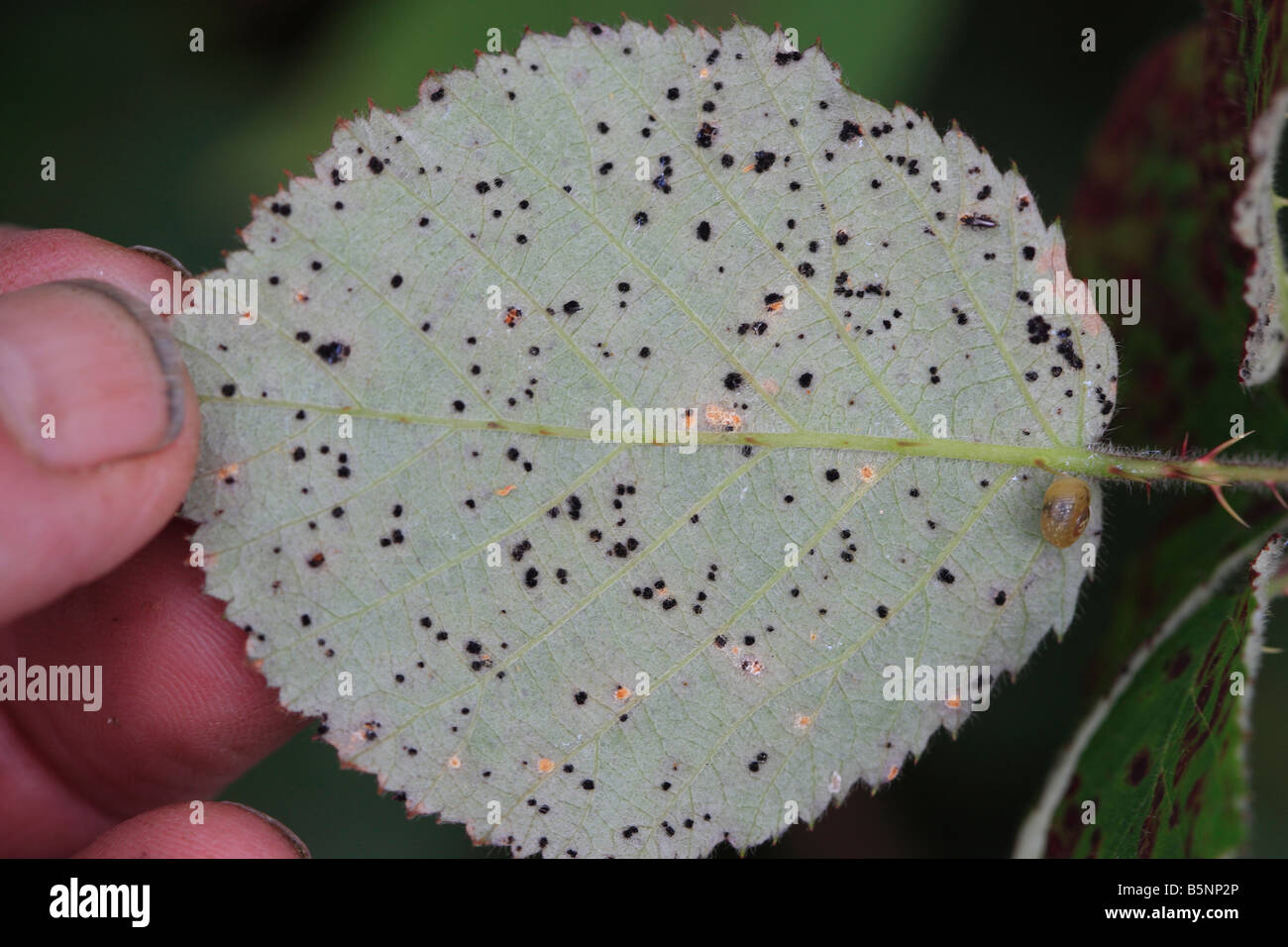 Pustules hi-res stock photography and images - Alamy