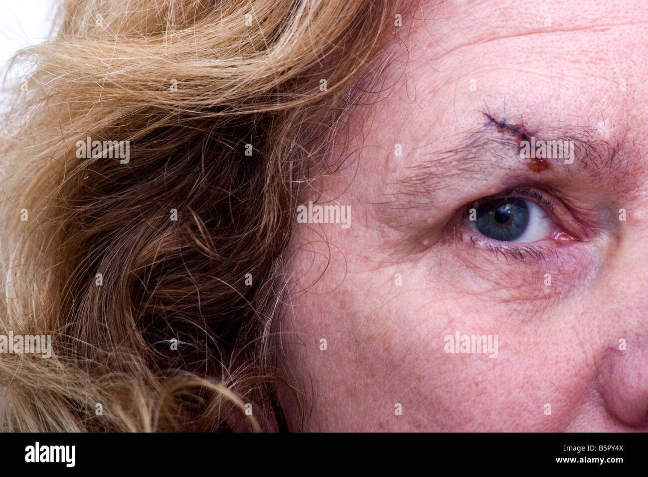 Stitches cut hi-res stock photography and images - Alamy