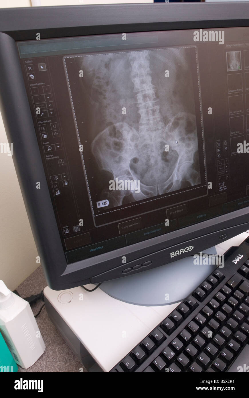 Radiographer uk hi-res stock photography and images - Alamy