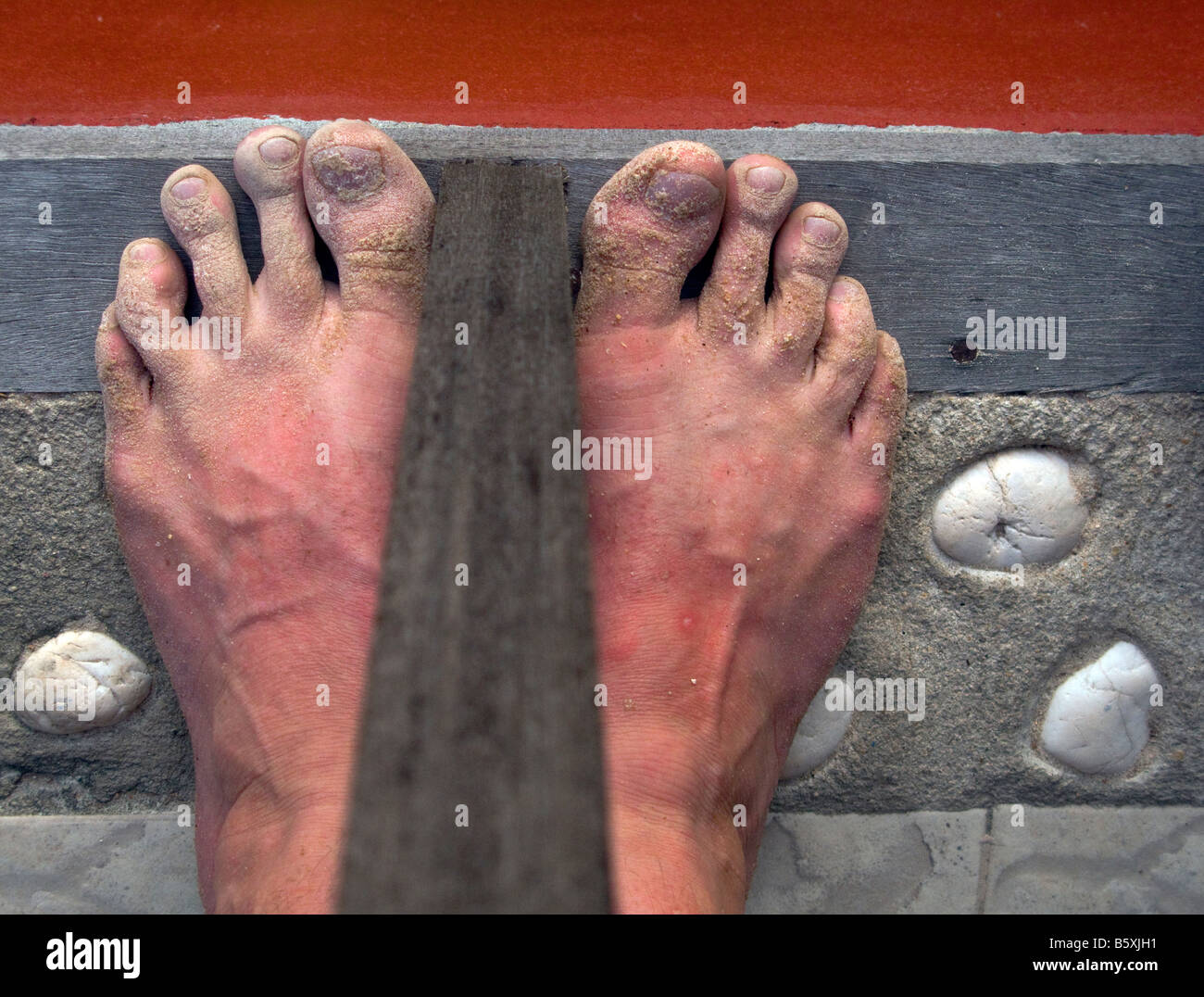 Sunburnt, sandy feet Stock Photo - Alamy