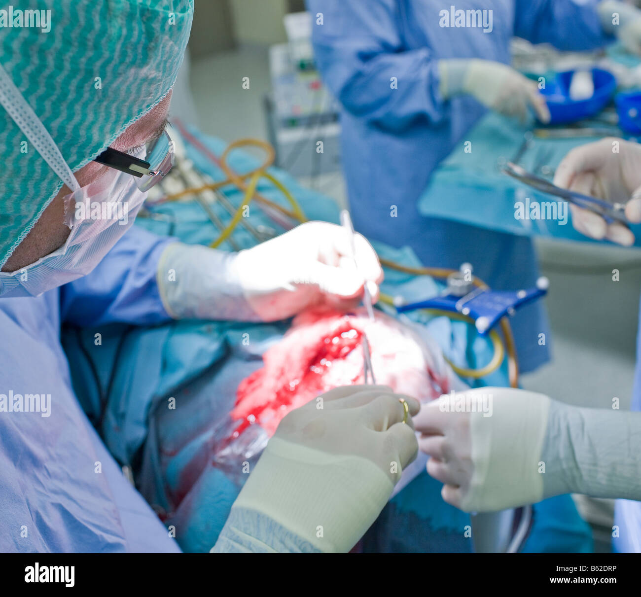 Brain Surgery Stitches