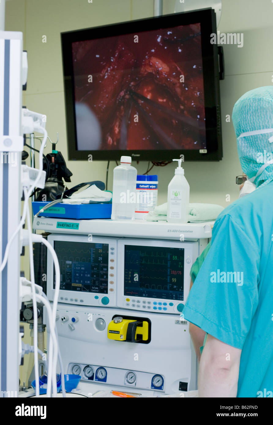 Neurosurgeon viewing computer image during brain surgery, Reykjavik ...
