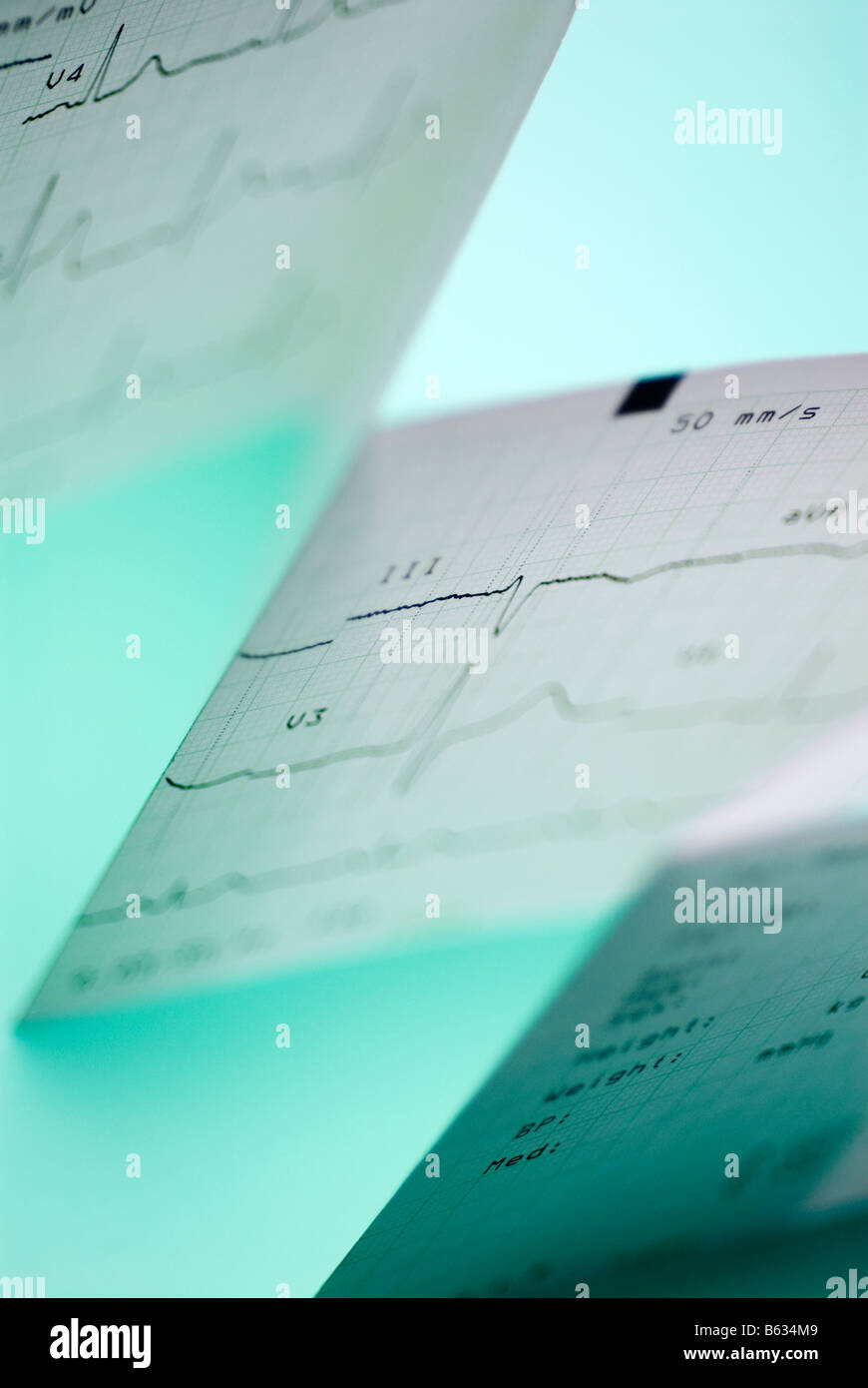 Electrocardiogram trace hi-res stock photography and images - Alamy