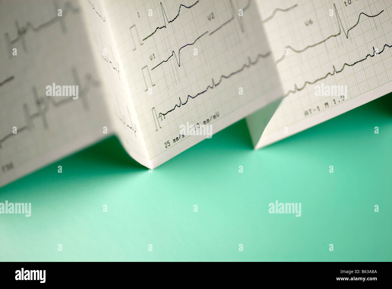 Electrocardiogram printout hi-res stock photography and images - Alamy