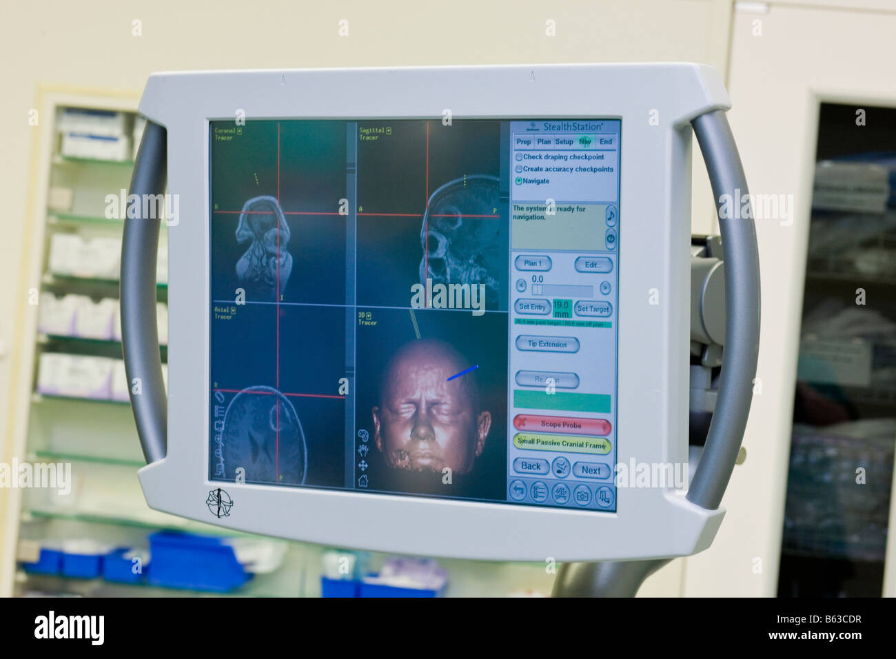 Patients Information On Computer Screen Used During Brain Surgery To Remove A Benign Tumor