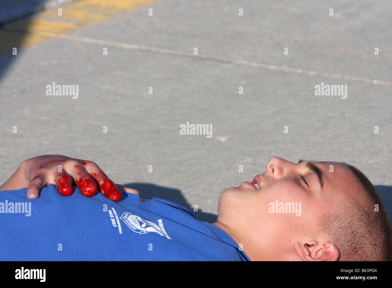 A teenage boy injured and laying on his back with blood on his hand ...