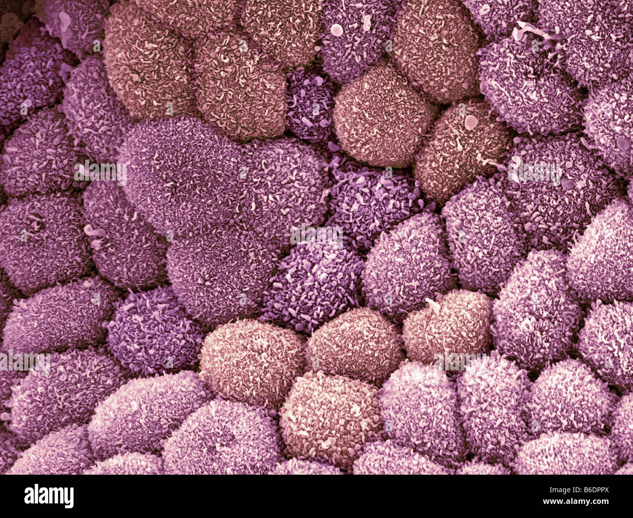 Internal lining of the gall bladder, coloured scanning electron ...