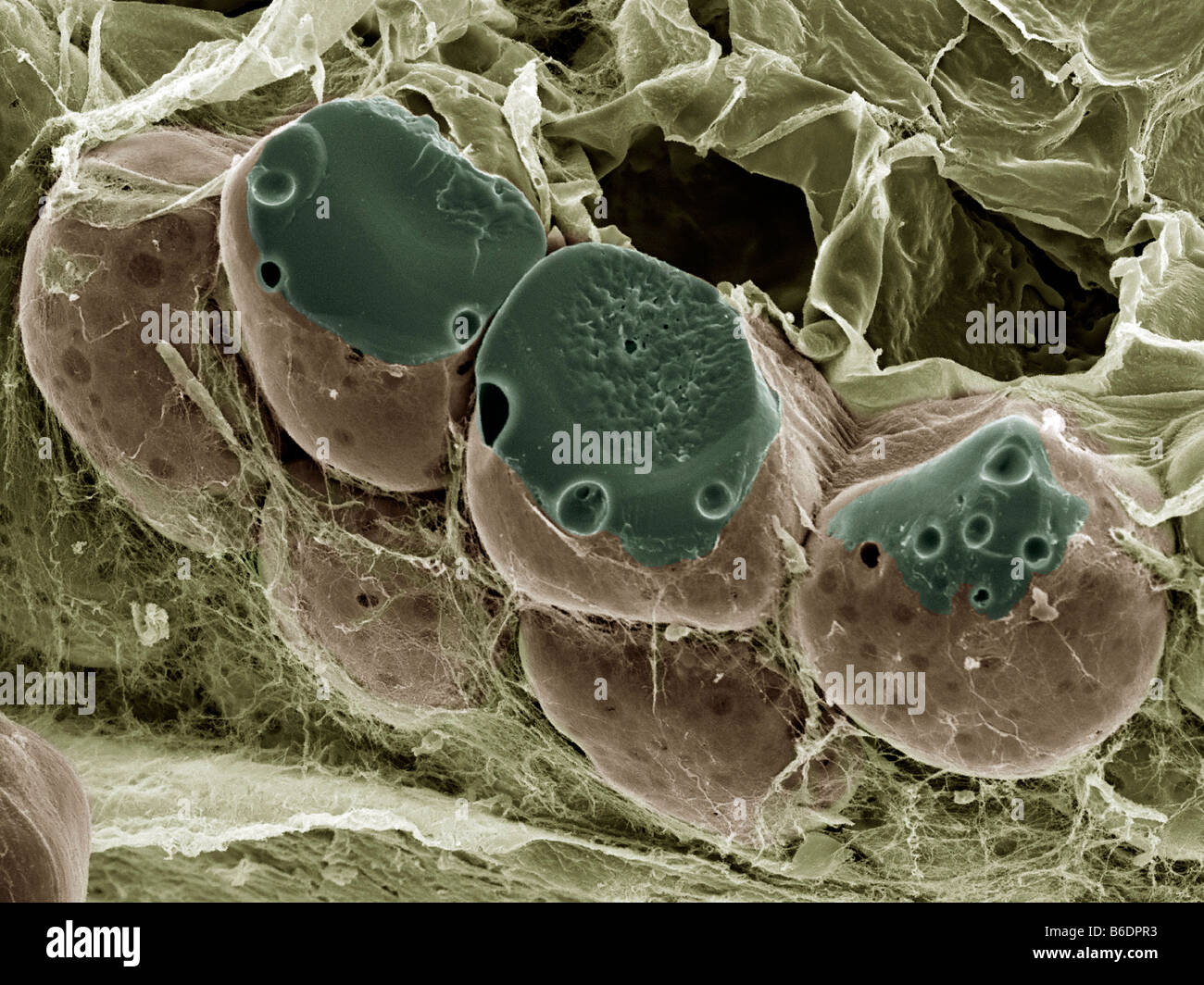 Fat (adipose) tissue,coloured scanning electronmicrograph, fat cells ...