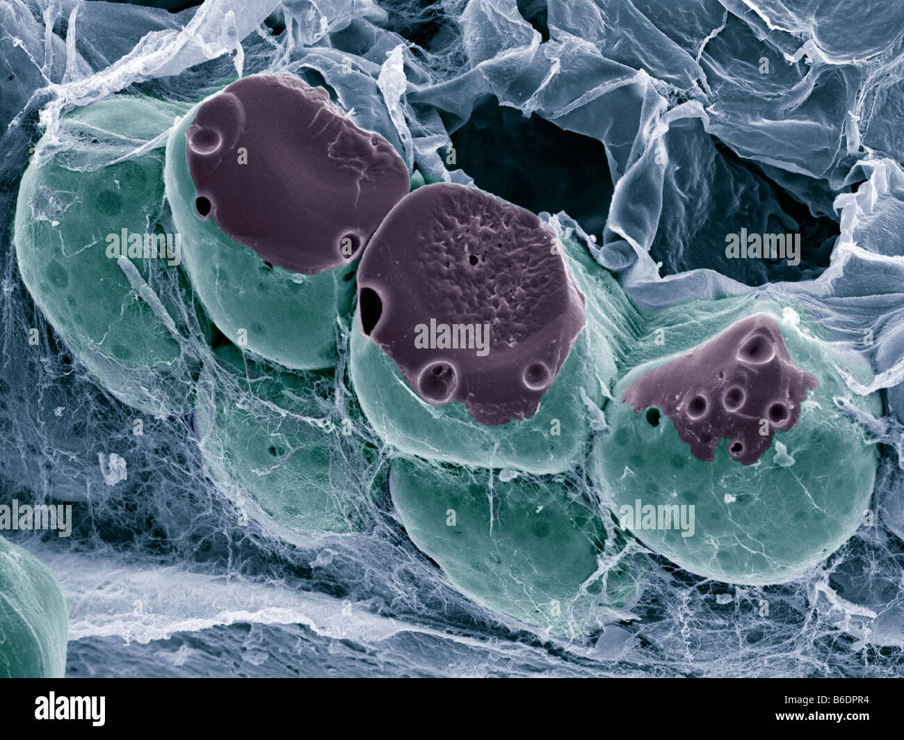 Fat (adipose) tissue,coloured scanning electron micrograph Stock Photo ...