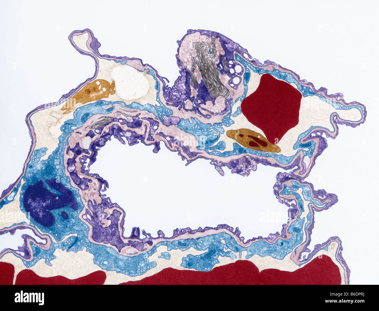 Transmission electron microscope color enhanced hi-res stock ...