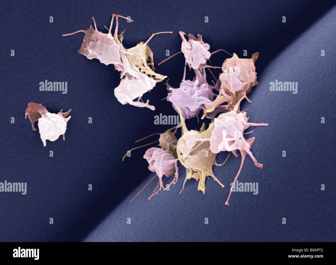 Activated platelets, coloured scanning electron micrograph (SEM). These ...