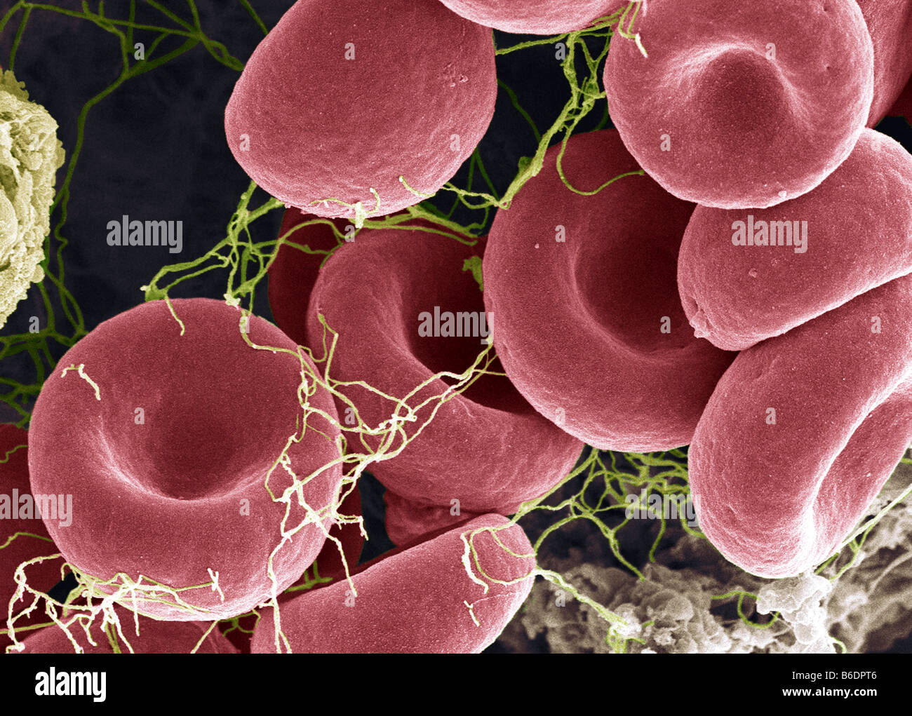 Electron Microscope Blood