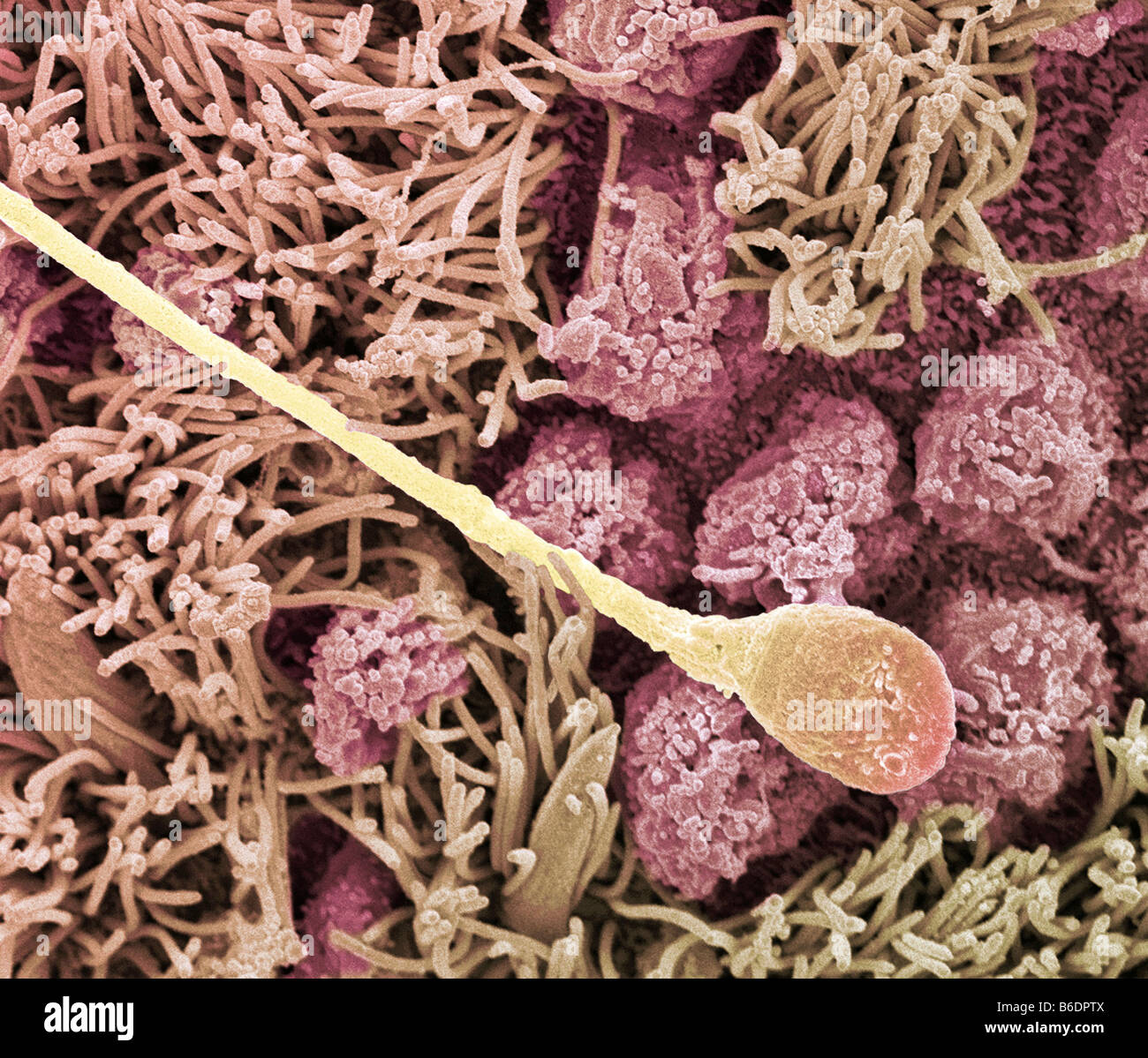 Sperm cell, coloured scanning electron micrograph (SEM Stock Photo - Alamy
