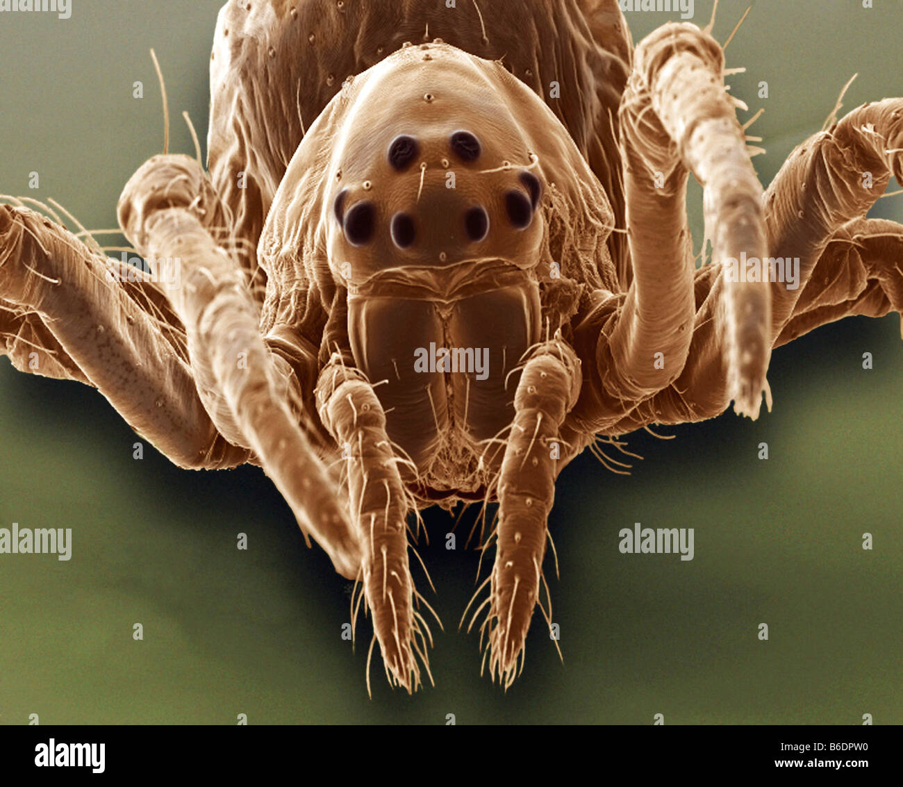 Baby spider, or spiderling, coloured scanning electron micrograph (SEM ...