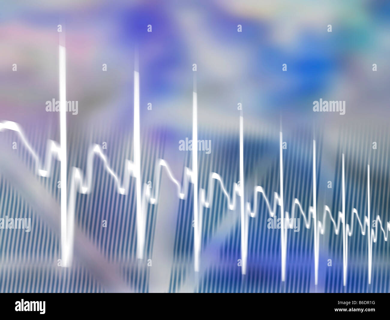 ECG, an electrocardiogram(ECG) showing a normal heart rate Stock Photo ...