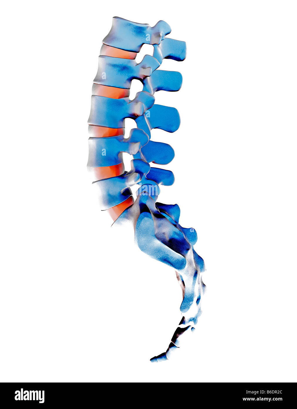 Lumbar spine and sacrum, The bones of spine (vertebrae) are cream and ...