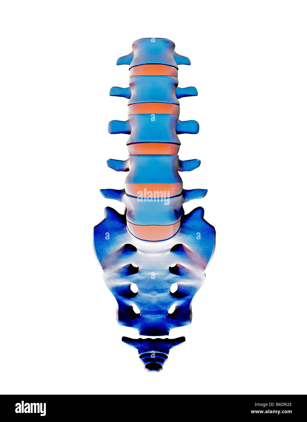 Lumbar spine and sacrum, The bones of spine (vertebrae) are cream and ...