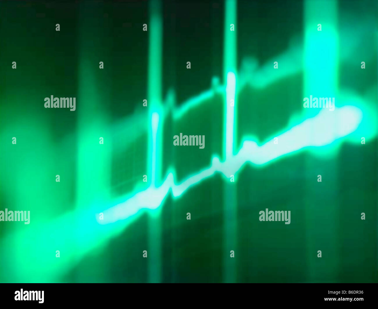 ECG, an electrocardiogram(ECG) showing a normal heart rate Stock Photo ...