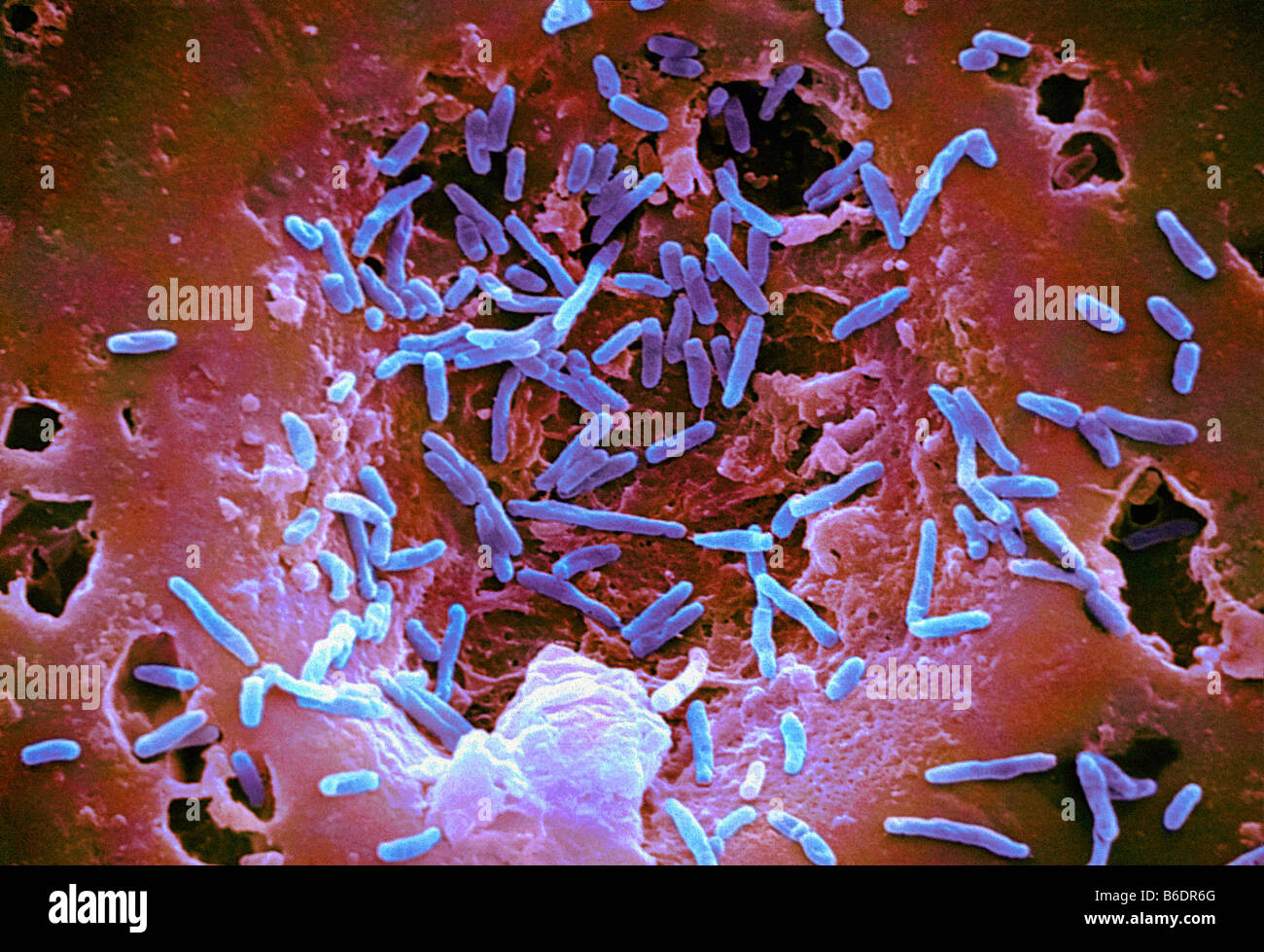 Mycobacterium chelonae sem hi-res stock photography and images - Alamy