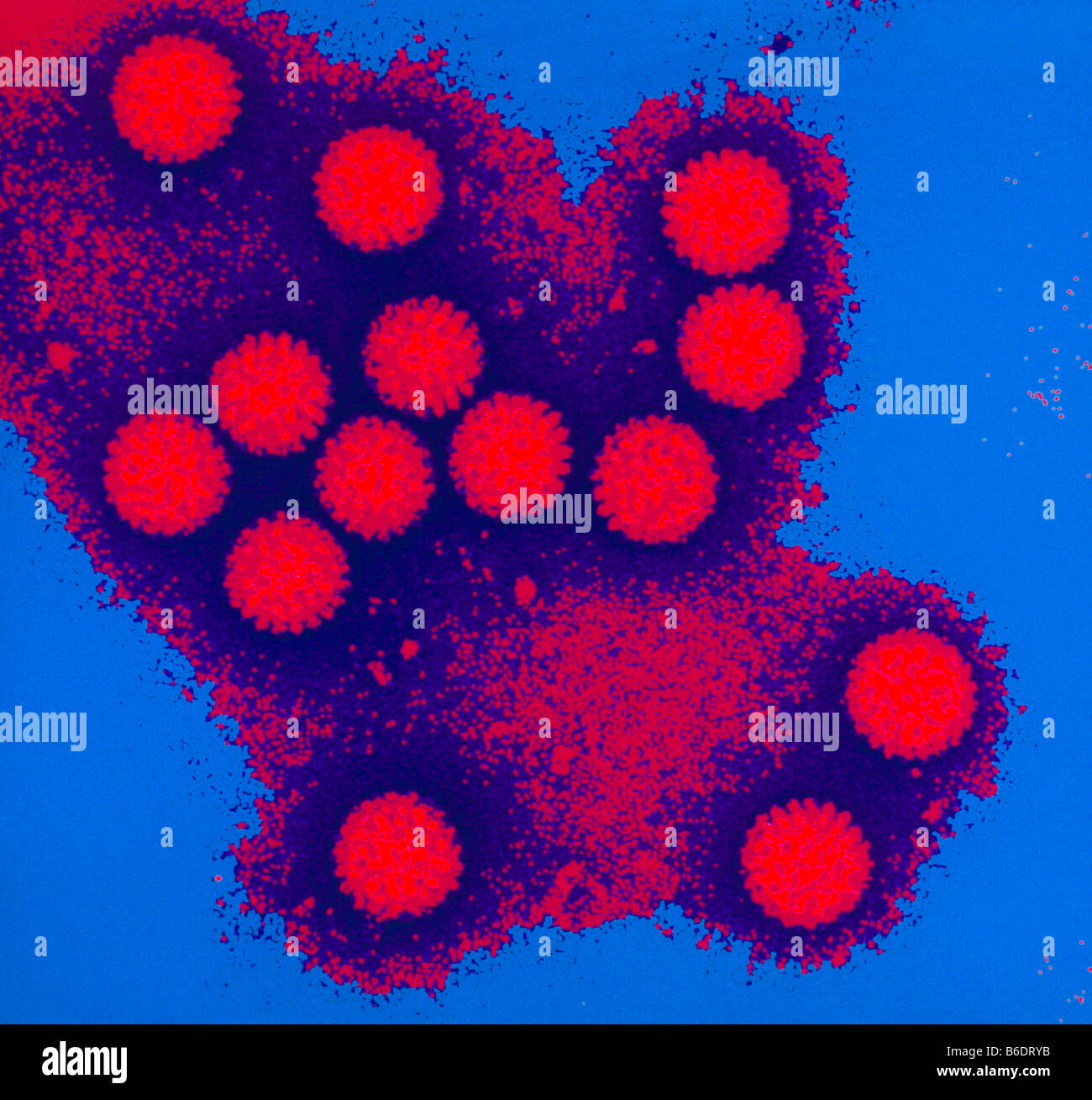 Rotaviruses. Coloured transmission electronmicrograph (TEM) of a ...