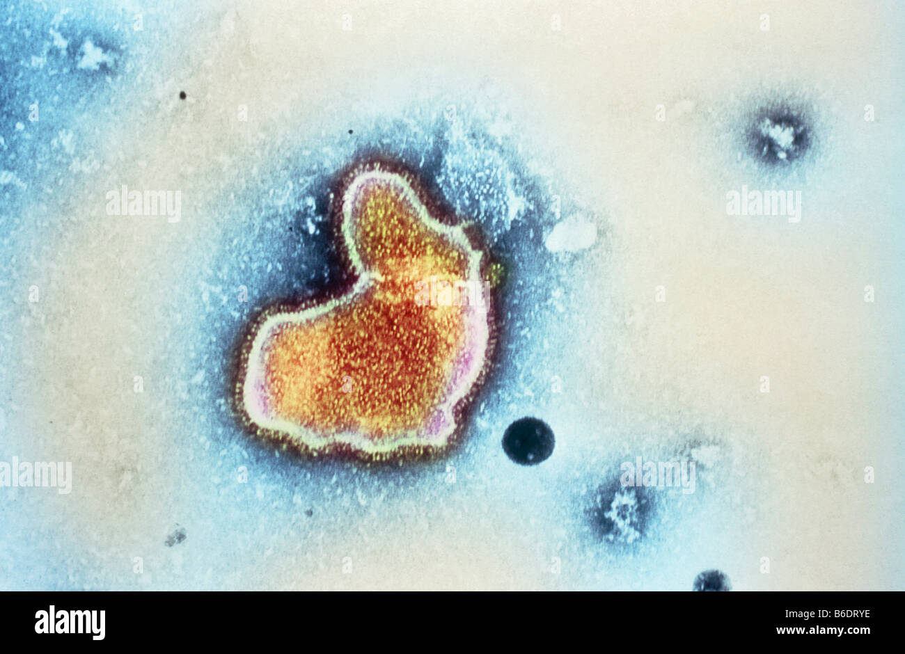 Respiratory syncytial virus. Coloured transmission electron micrograph ...