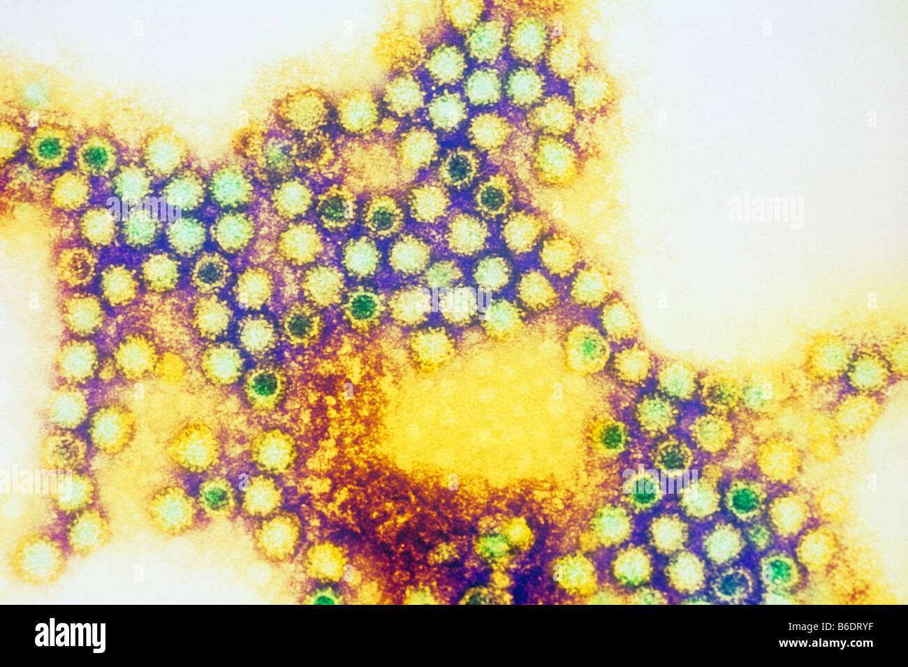 Caliciviruses. Coloured transmission electronmicrograph (TEM) of feline ...