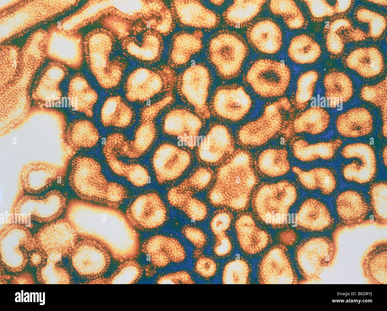 Coloured tem influenza viruses hi-res stock photography and images - Alamy