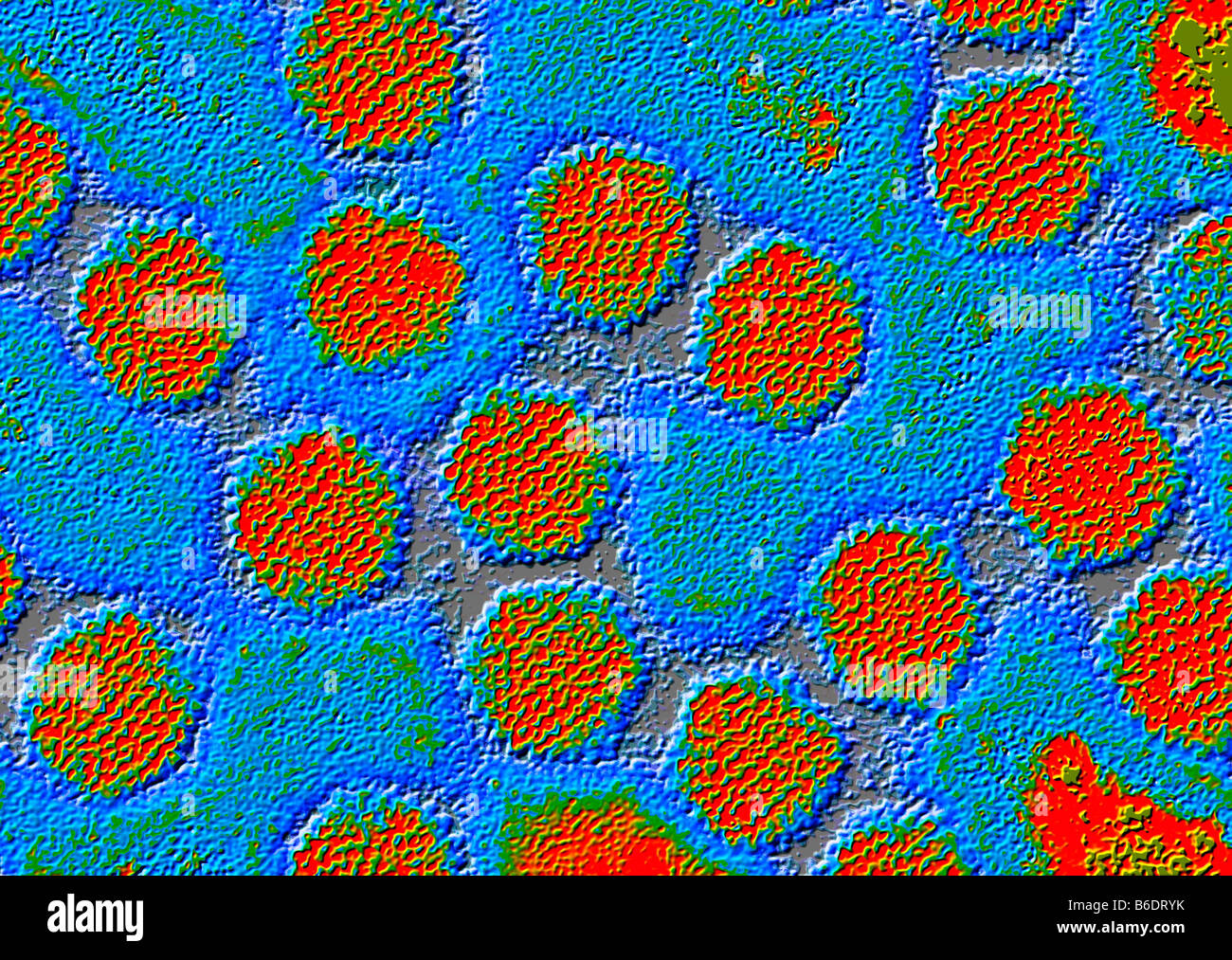 Adenoviruses. Coloured transmission electronmicrograph (TEM) of ...