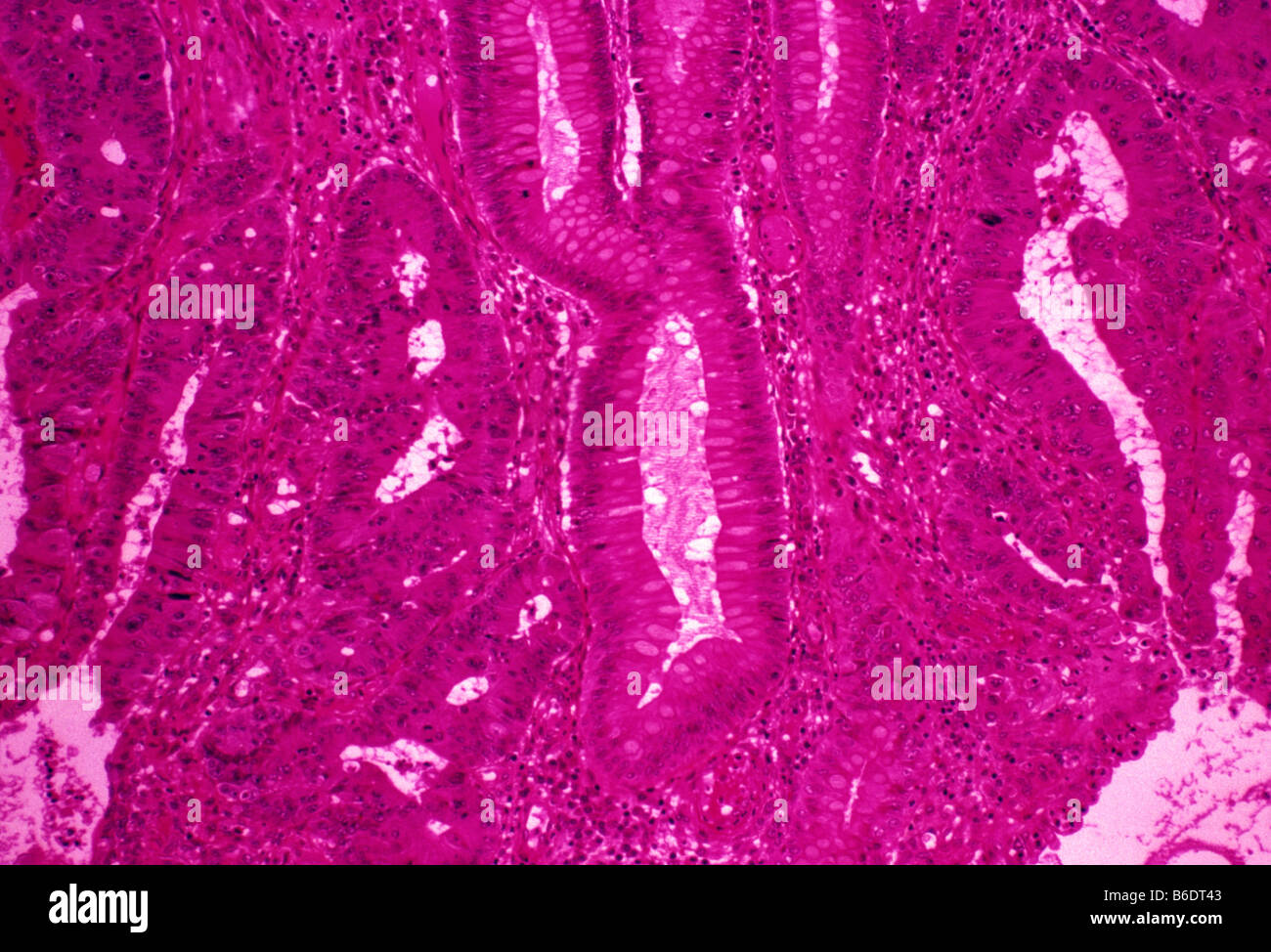Sigmoid High Resolution Stock Photography and Images - Alamy