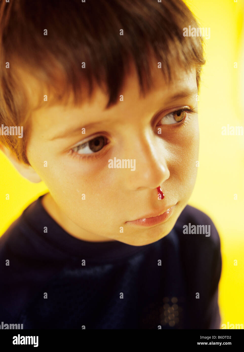 Boy nosebleed hi-res stock photography and images - Alamy