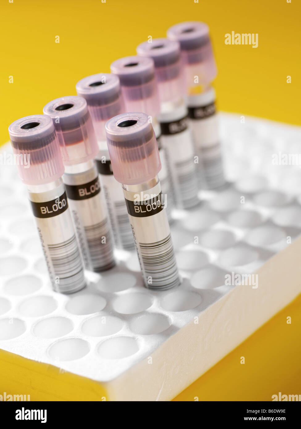 Blood samples. Blood sample tubes in a polystyrene tray Stock Photo - Alamy