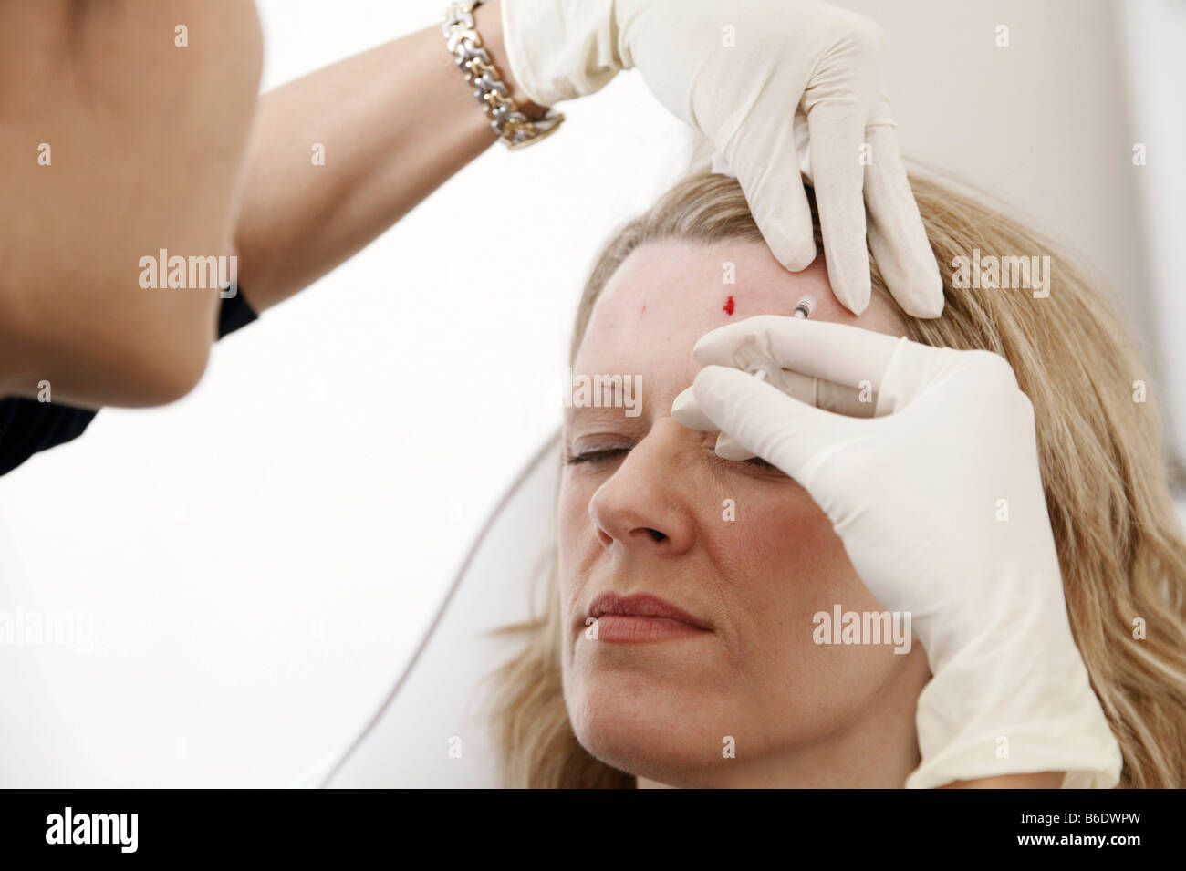 Botox treatment. Clinician injecting botox into a female patient's ...
