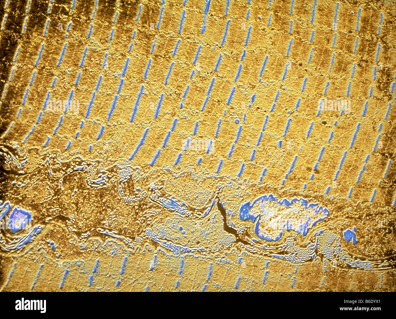 False-colour transmission electron micrograph(TEM) of human striated muscle Stock Photo - Alamy