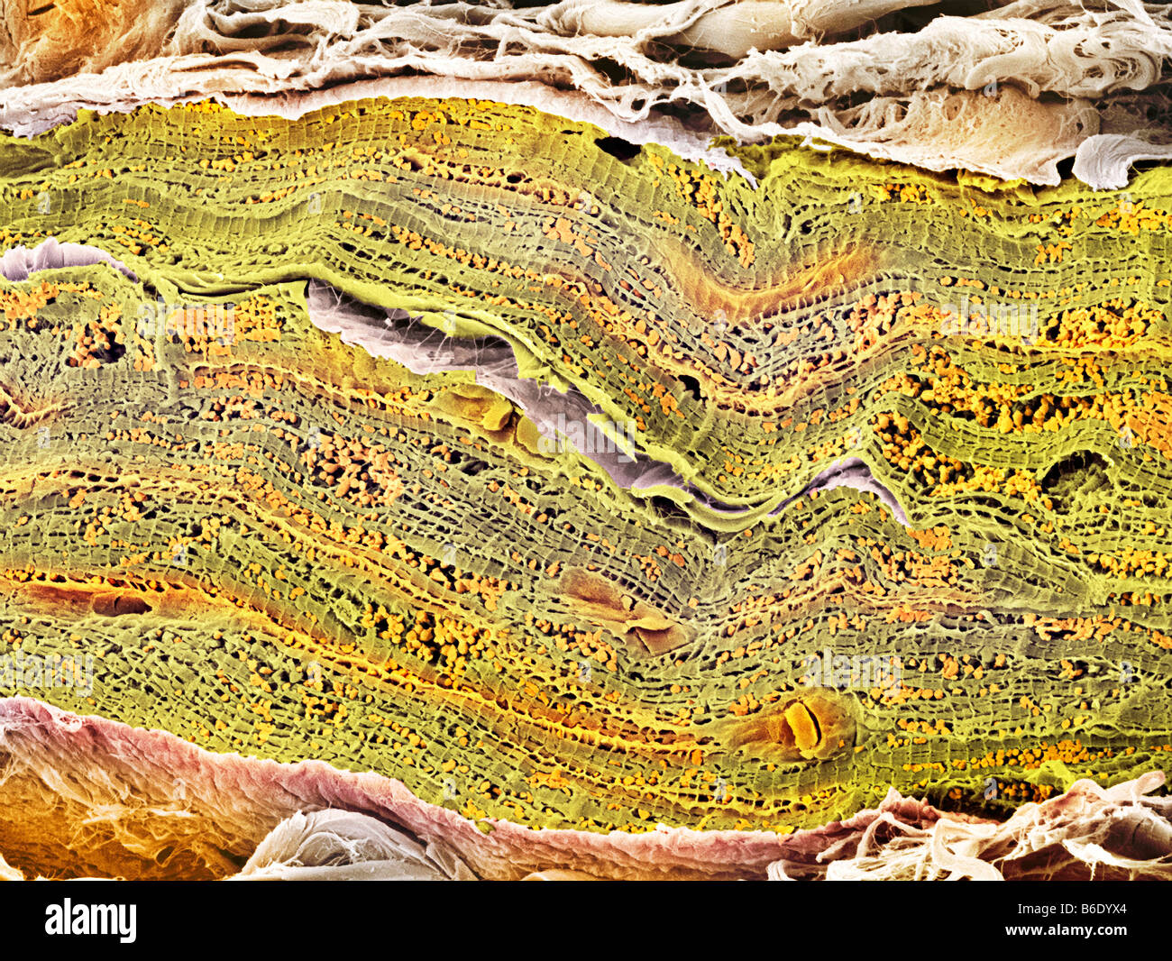 Cardiac Muscle Coloured Scanning Electron Micrograph Sem Of A Bundle