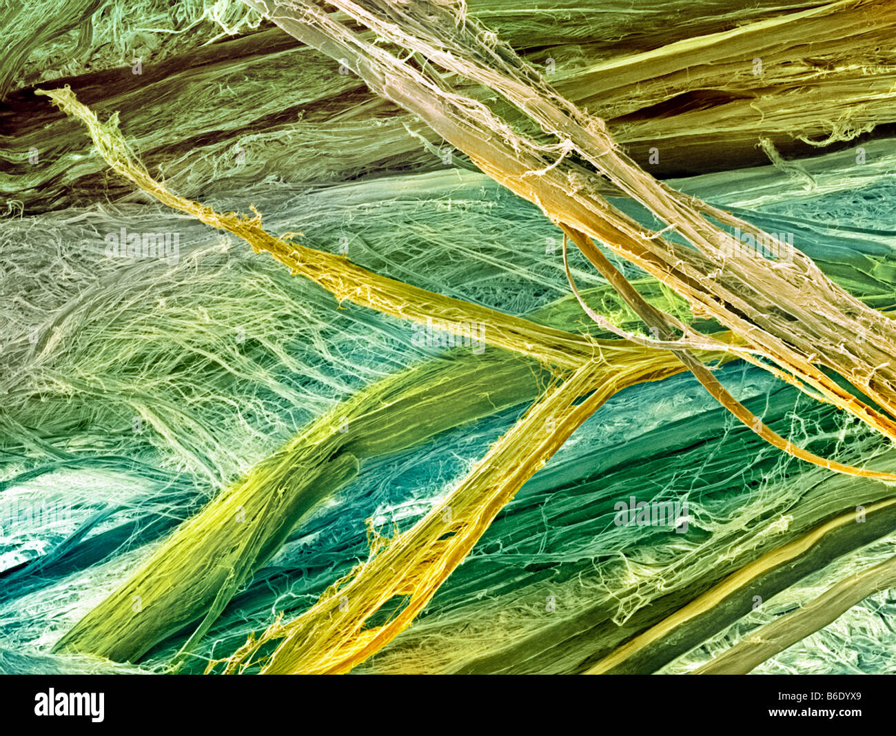 Tendon fibres. Coloured scanning electron micrograph (SEM) of tendon ... Tendon fibres. Coloured scanning electron micrograph (SEM) of tendon ...