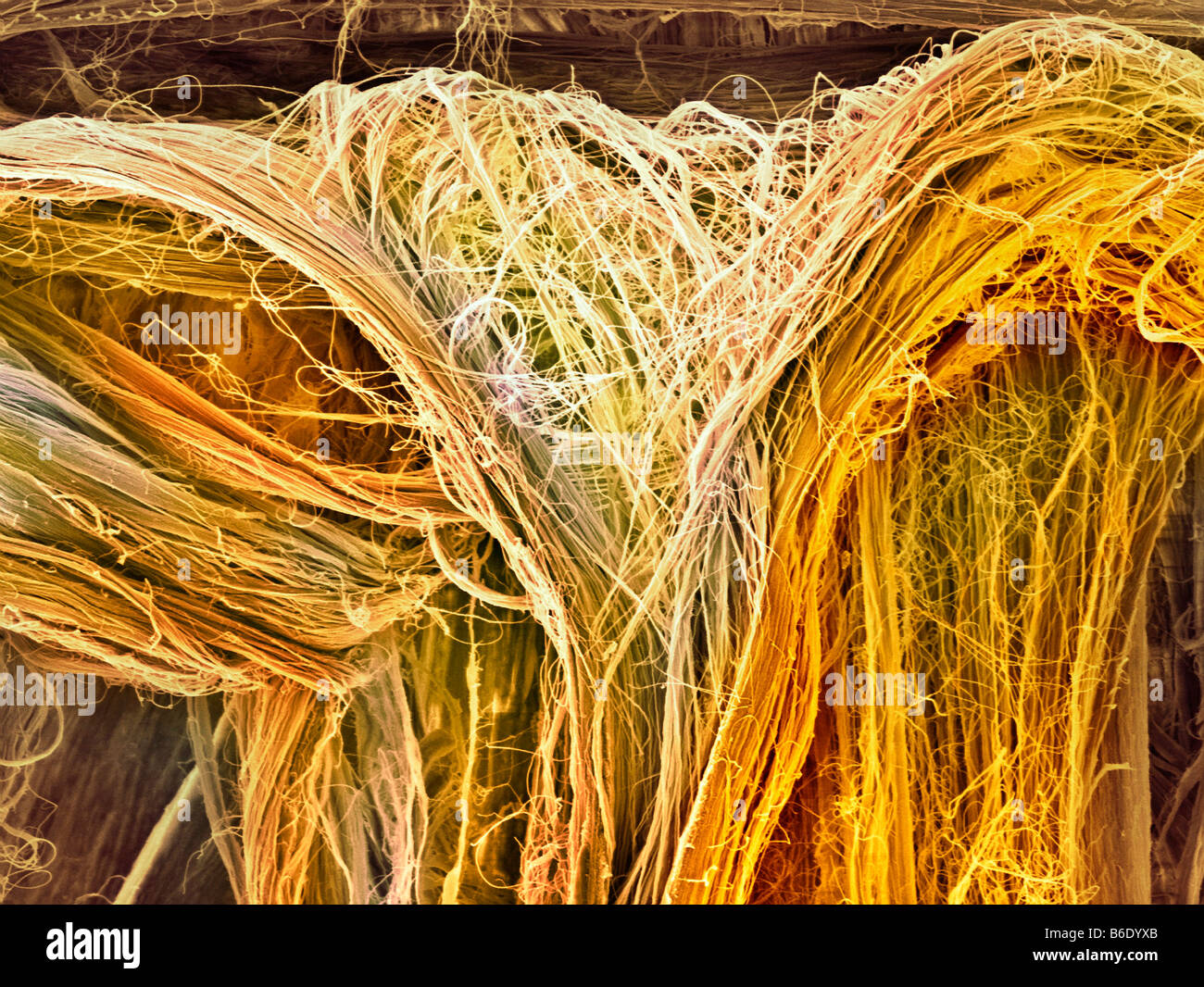 Tendon fibres, Coloured scanning electron micrograph (SEM) of tendon ... Tendon fibres, Coloured scanning electron micrograph (SEM) of tendon ...