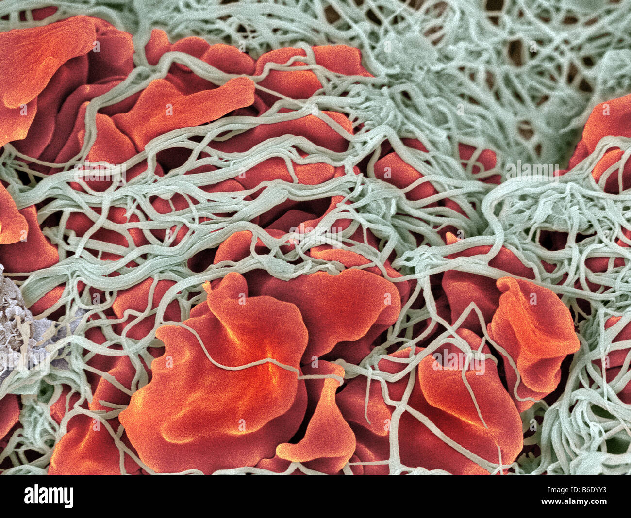 Blood clot, Coloured scanning electron micrograph (SEM) of blood ...