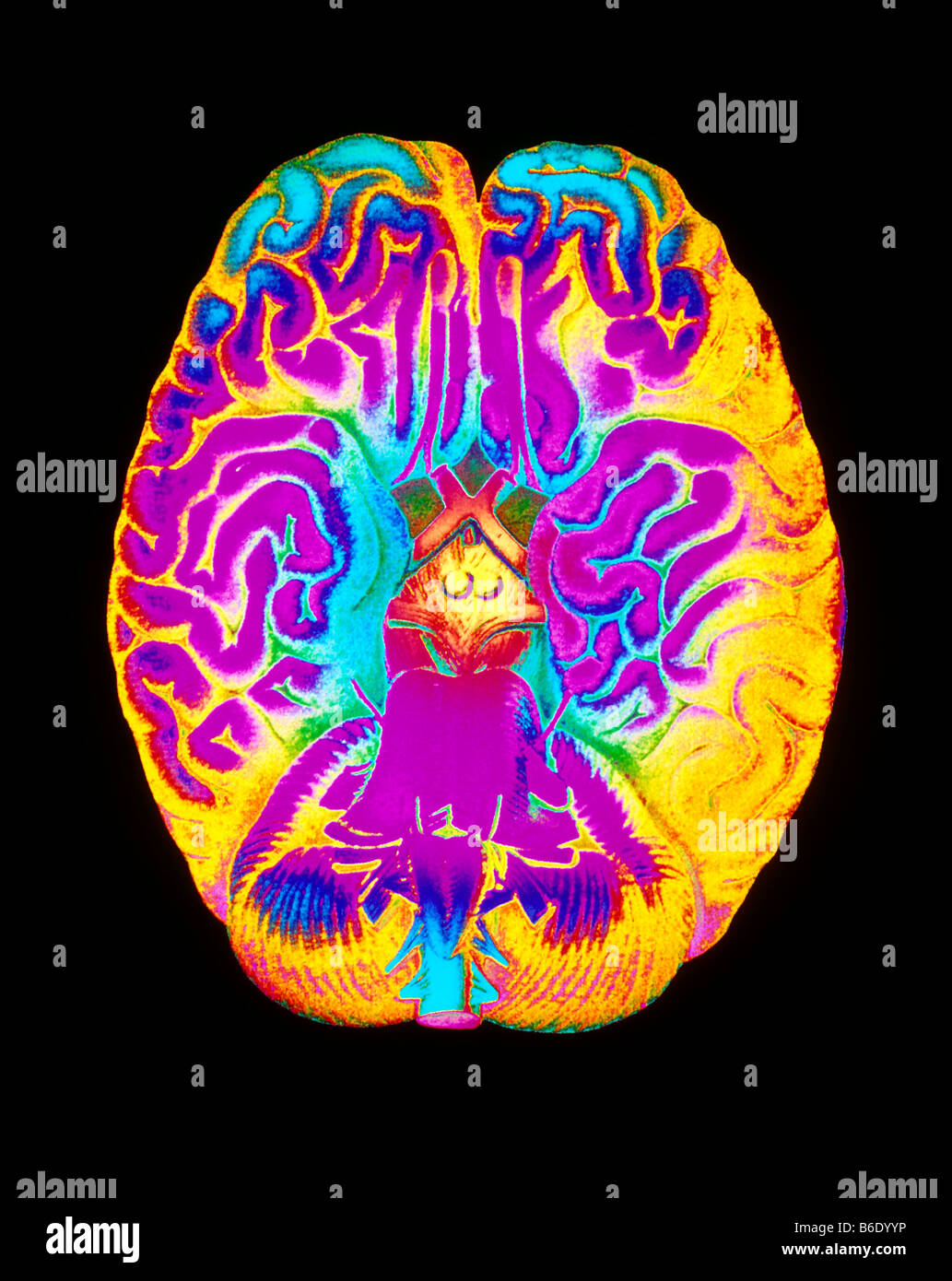 Human Brain, Computer-enhanced historical artwork of the human brain ...