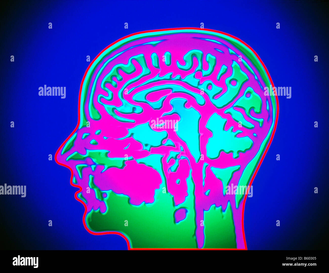 Normal human brain, Coloured magnetic resonance imaging (MRI) scan of a ...