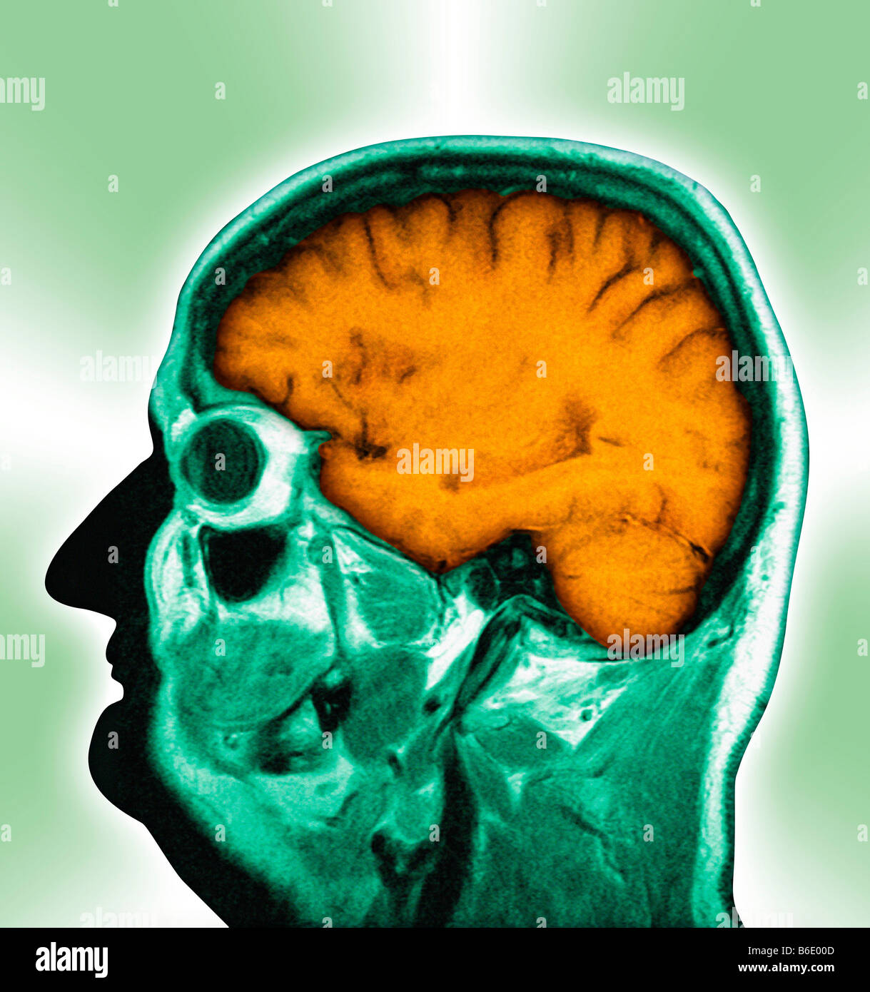 Normal human brain, Coloured magnetic resonance imaging (MRI) scan of a human head Stock Photo ...