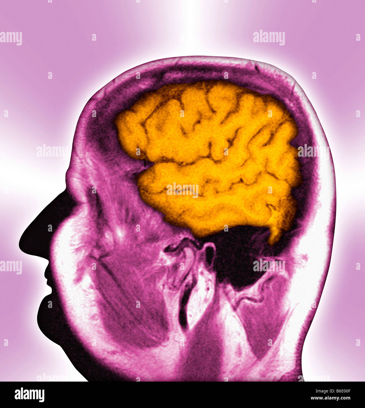 Normal human brain, Coloured magnetic resonance imaging (MRI) scan of a human head Stock Photo ...