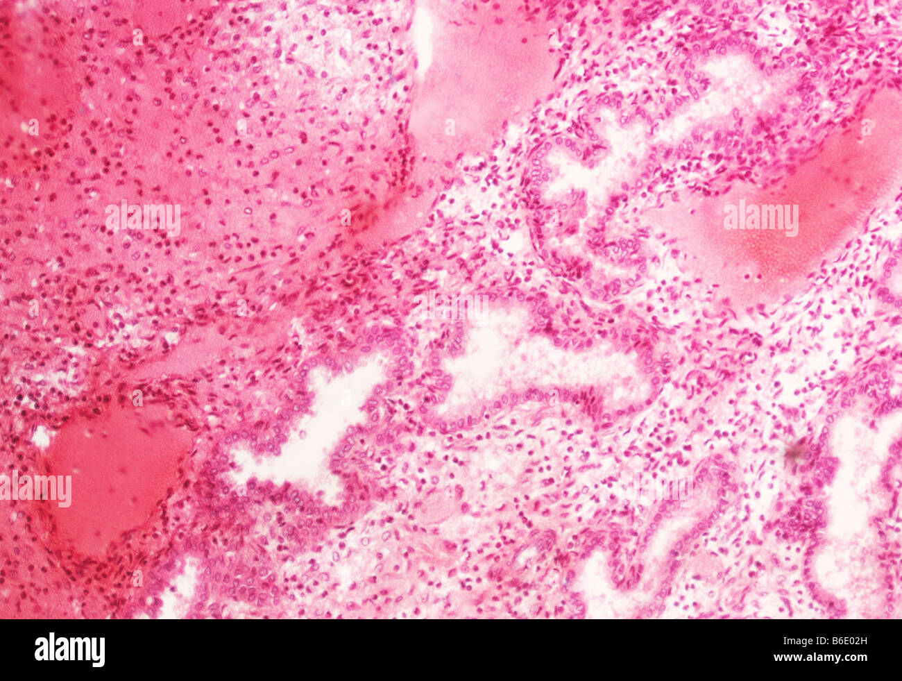 Endometrium hi-res stock photography and images - Alamy