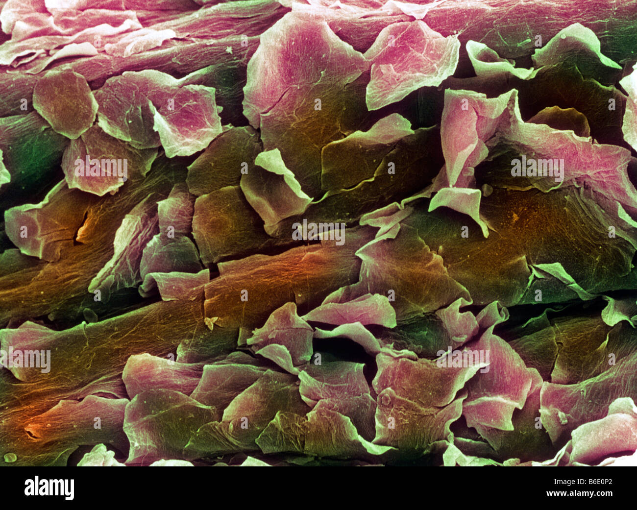 Human skin, sem epidermis High Resolution Stock Photography and Images ...